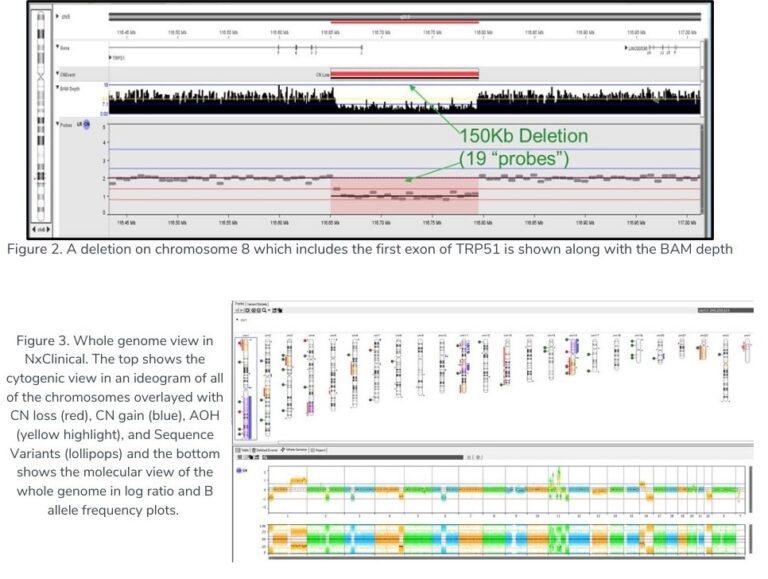 Whole-Genome CNV Analysis: A Brief Guide - bionanogenomics