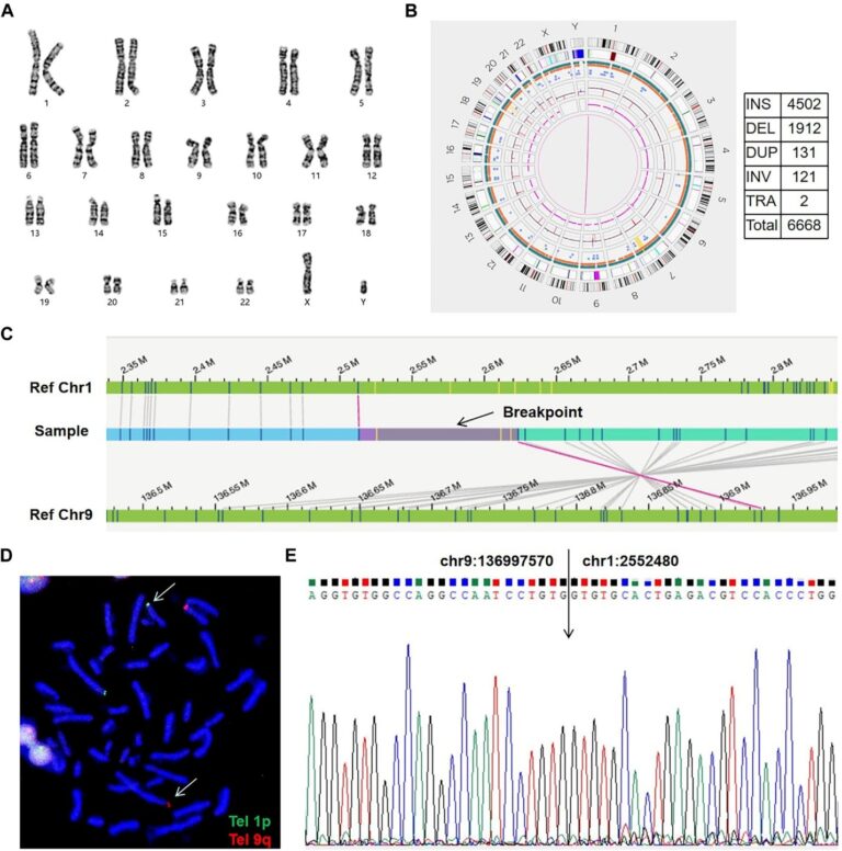 Optical Genome Mapping: A Beacon of Hope for Understanding Recurrent ...